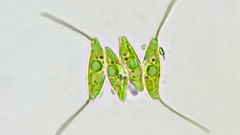 ZŠ Kunratice | Malé osudy – výstava mikroorganismů